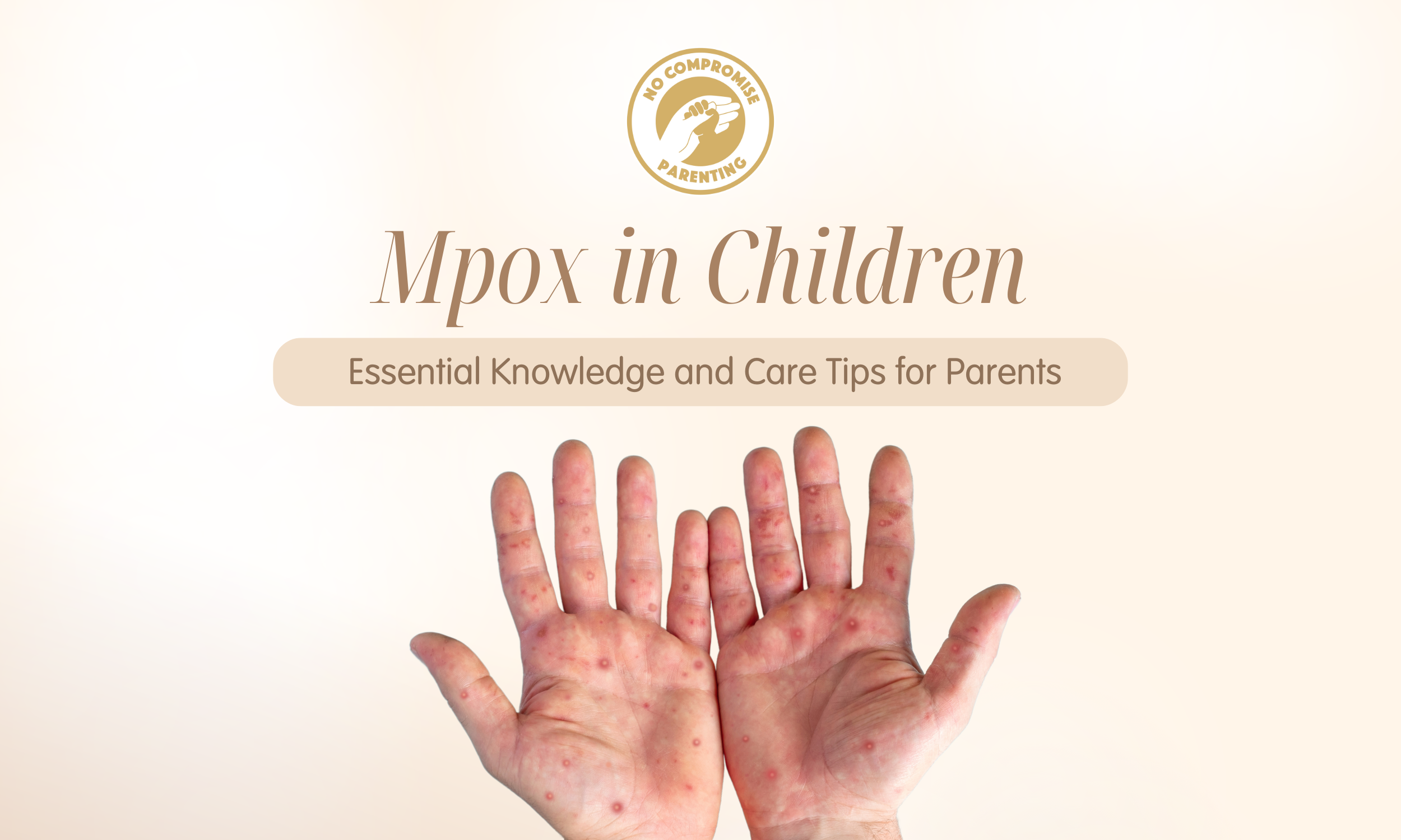 Mpox in Children: Essential Knowledge and Care Tips for Parents ...
